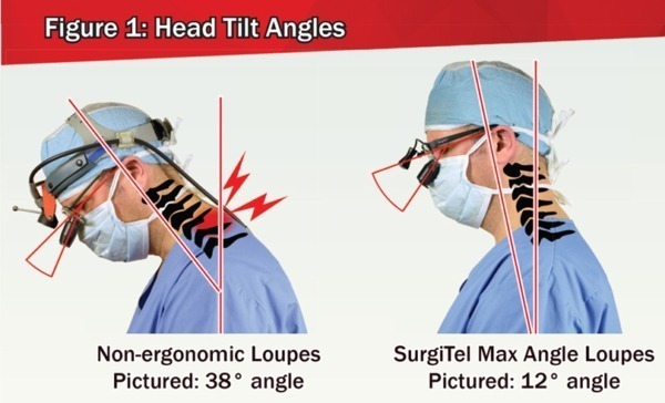 Guidelines for Selecting Clinical Loupes - Ergonmic Loupes | SurgiTel