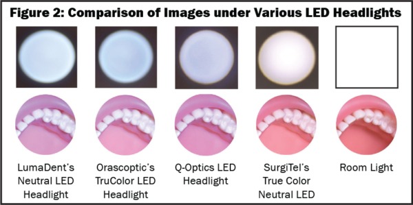 LumaDent’s Neutral vs. SurgiTel’s True Color Neutral