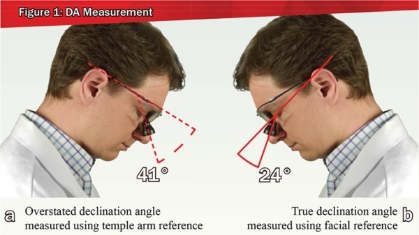 Demystifying Declination Angle - SurgiTel Ergonomic Loupes