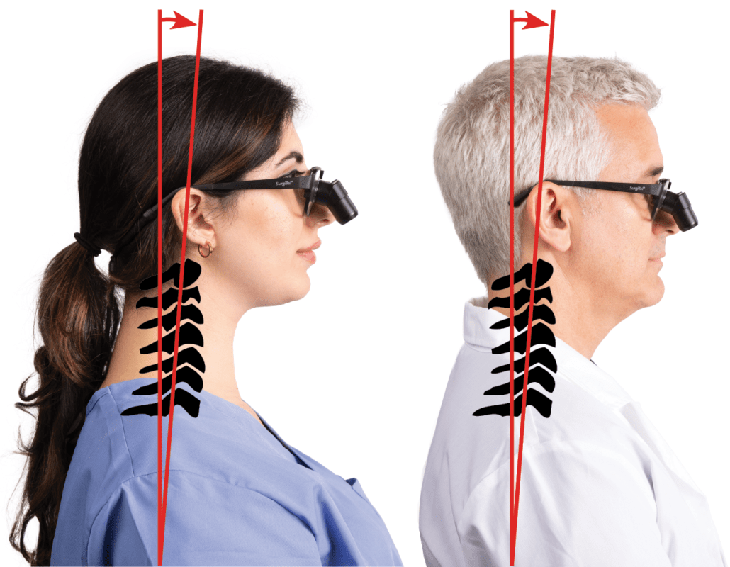 SurgiTel’s Hybrid Ergo™ Loupes: Best of Ergonomics and Direct Vision ...